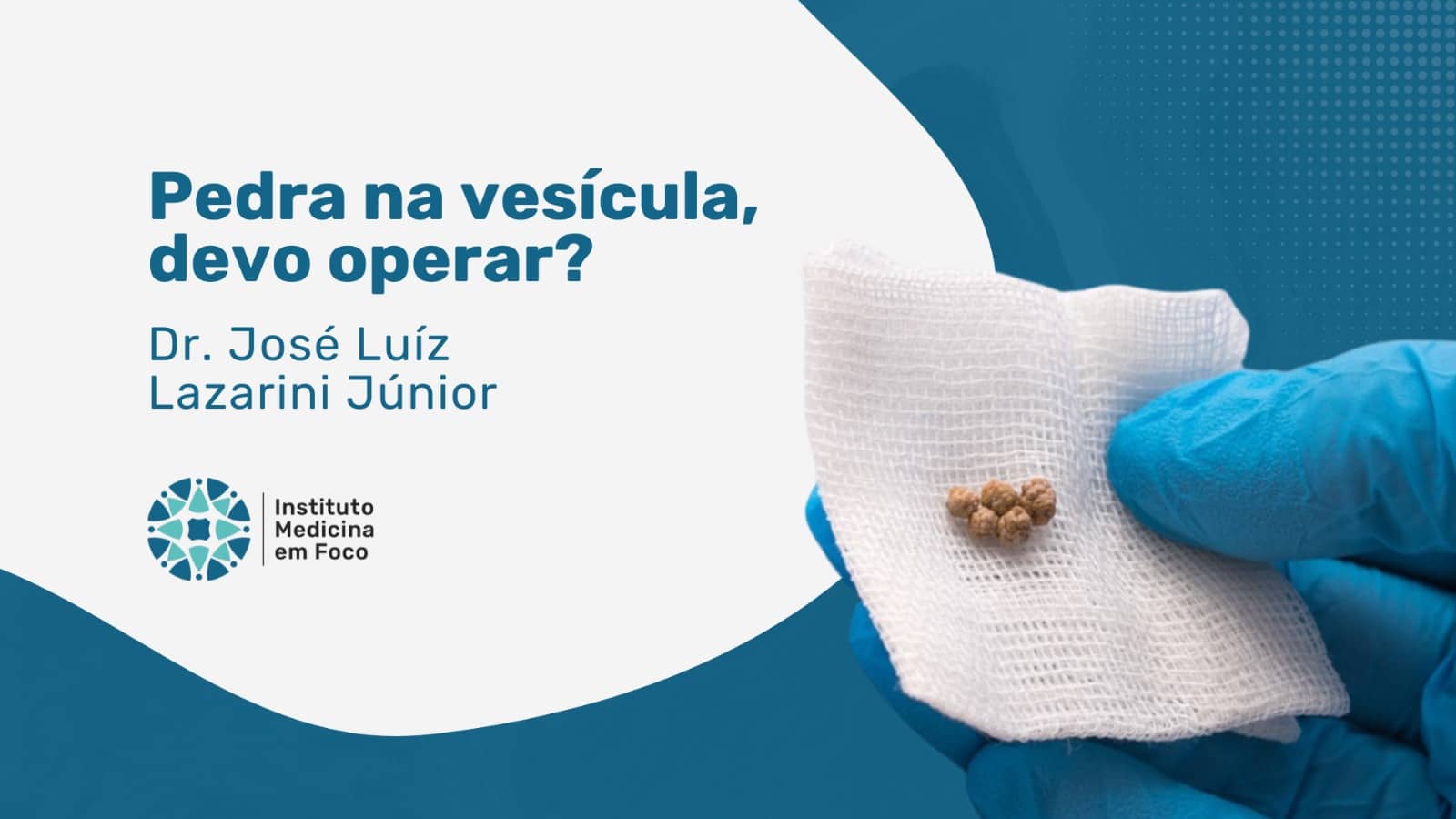Pedra na Vesícula: tudo o que você precisa saber Pedra na Vesícula: tudo o que você precisa saber