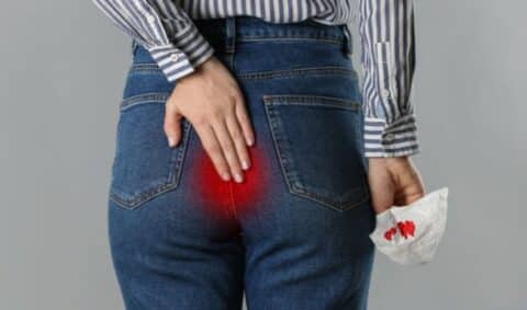 Tratamento para hemorroida sem cirurgia, quais as opções?