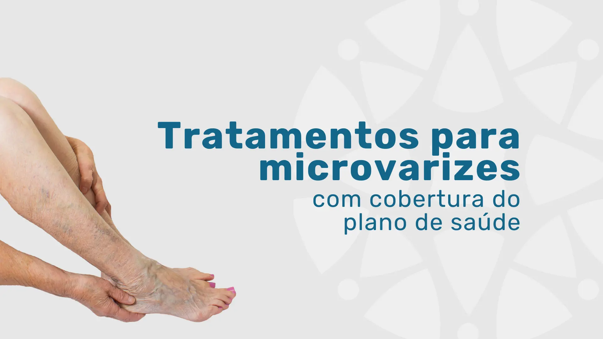 Tratamento para microvarizes pela Omint Saúde