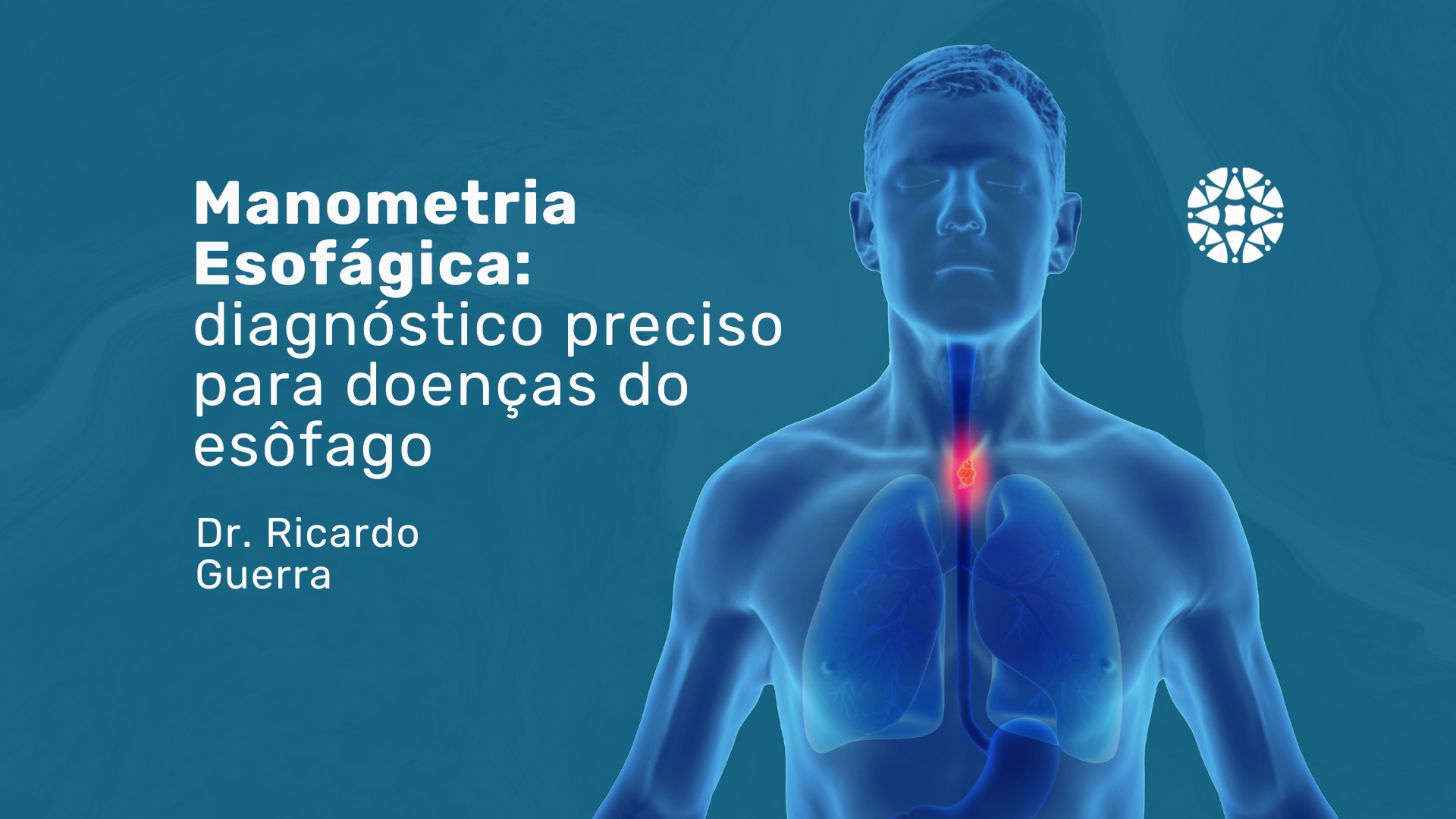 What is Esophageal Manometry and what is it for?