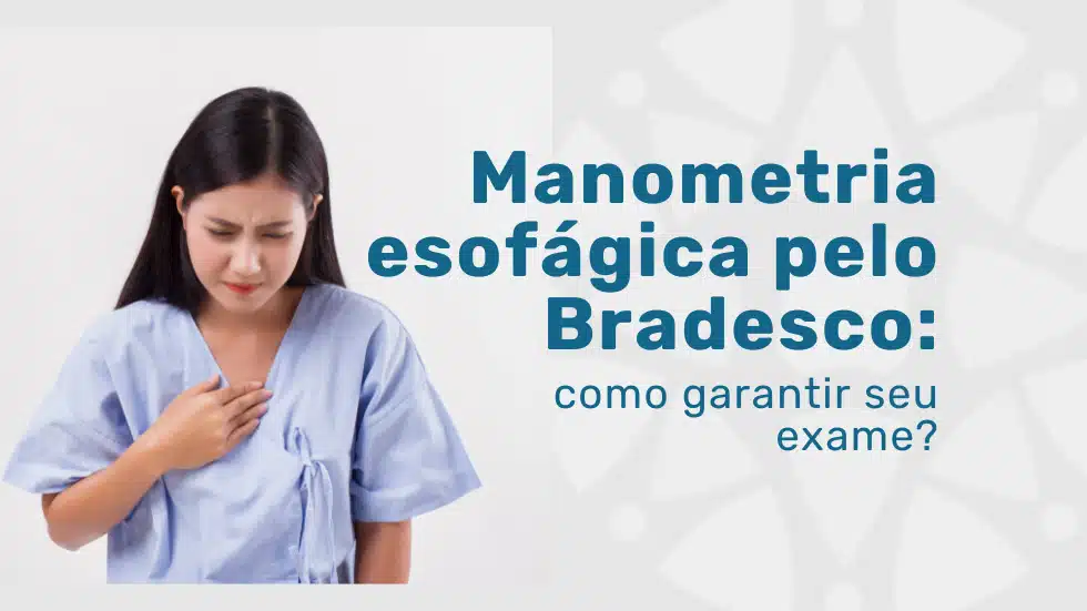 Manometria esofágica pelo Bradesco: como garantir seu exame?