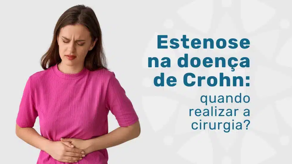 Crohn: quando fazer cirurgia de estenose intestinal?